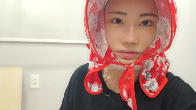 35살 안면거상 | SOOP VOD